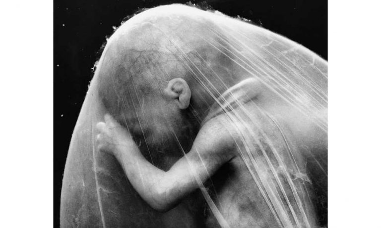 ¿Cuándo se sacaron las primeras fotos de un feto dentro del útero ...