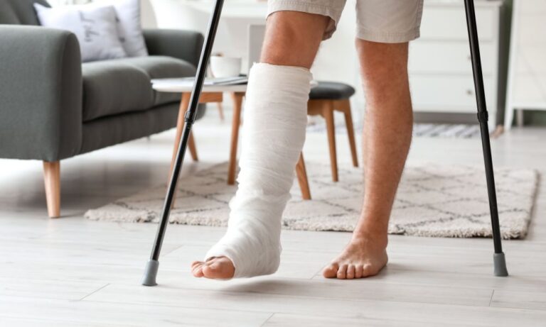 La ciencia de la fractura: ¿cómo se arregla un hueso roto? - Billiken